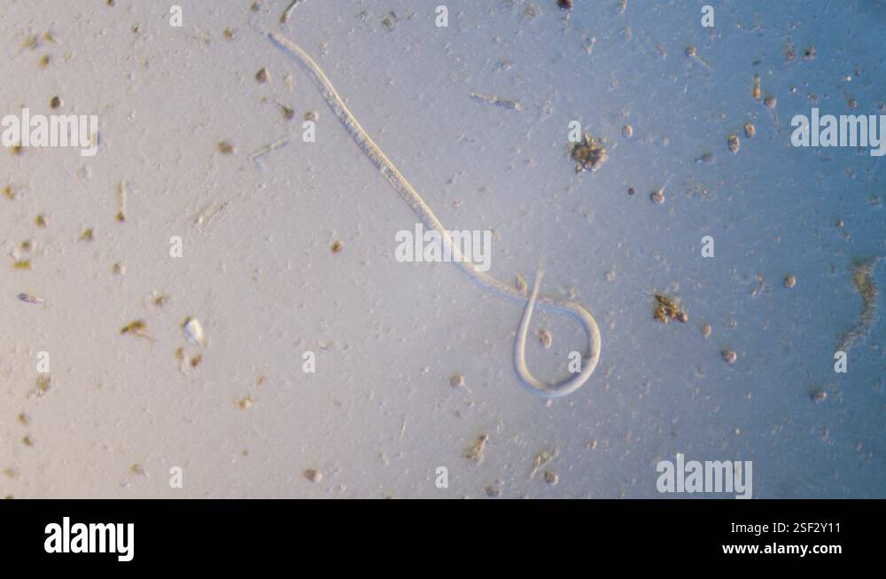 Nematode parasitic worm in microscope bright field Stock Video Footage - Alamy