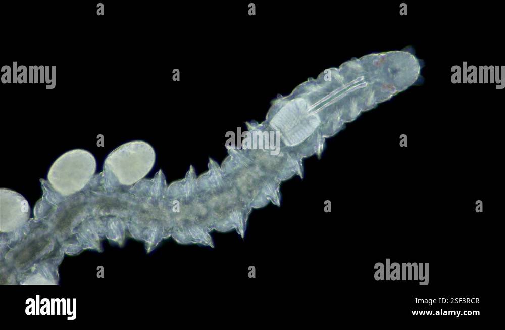 Worm family Syllidae under a microscope, Polychaeta class, Exogoninae ...