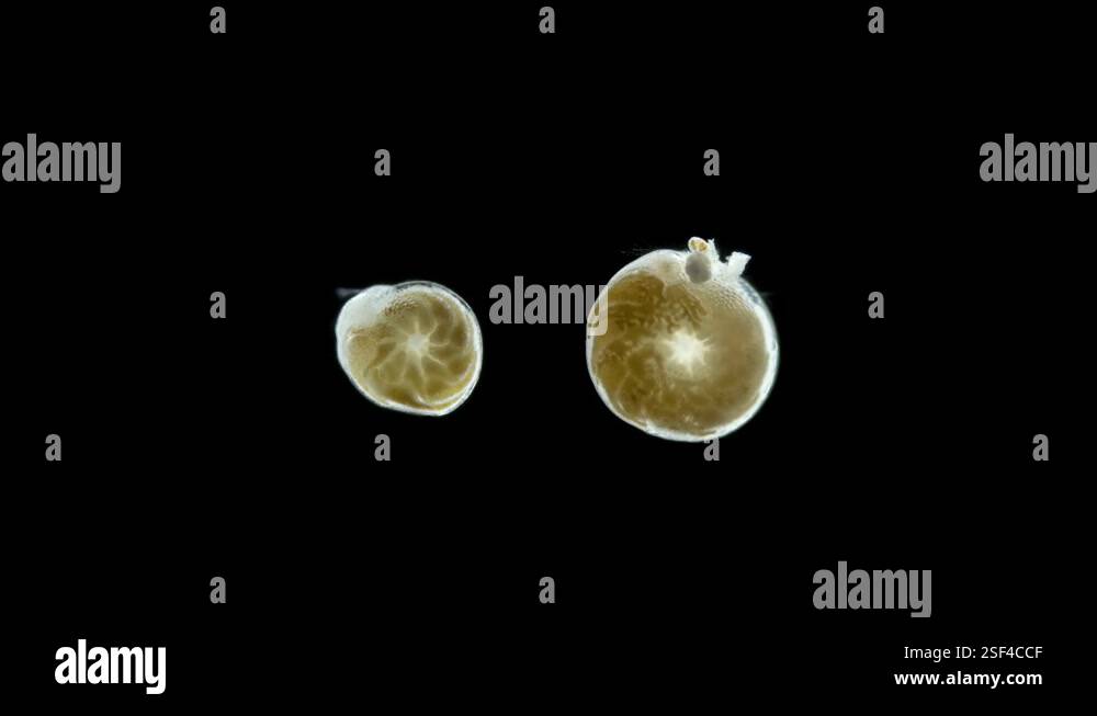Foraminifera under a microscope, class Rotaliata, possibly order ...