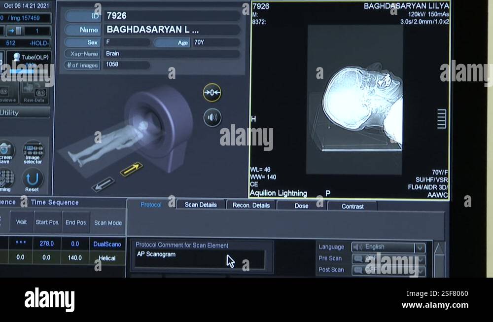 MRI scan screen animation. Computed medical tomography MRI Stock Video Footage - Alamy