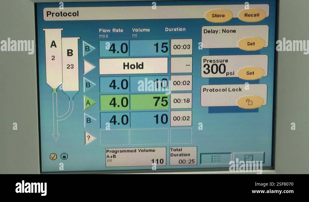 MRI scan screen animation. Computed medical tomography MRI Stock Video ...