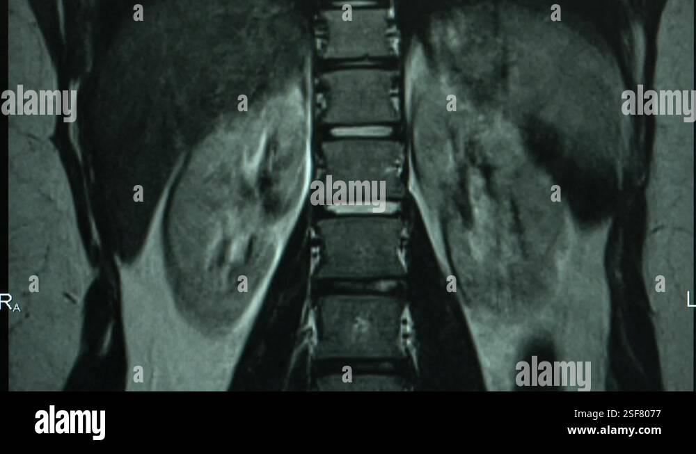 MRI scan screen animation. Computed medical tomography MRI Stock Video ...