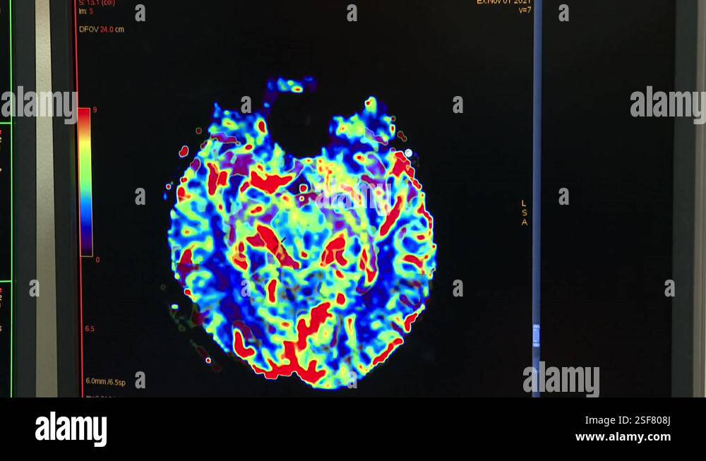 MRI scan screen animation. Computed medical tomography MRI Stock Video ...