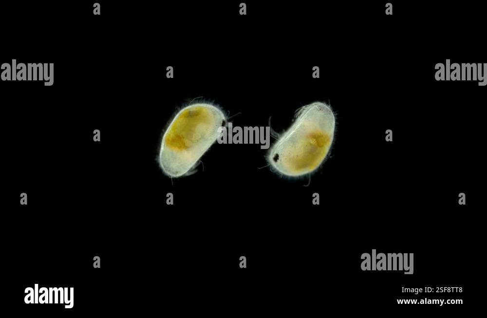 Freshwater ostracoda under a microscope, Oligostraca Superclass. The ...