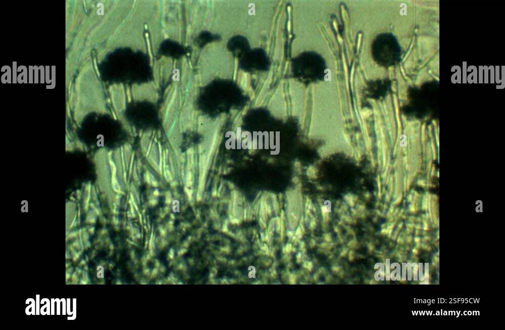 1960s: Microscopic view of mold Stock Video Footage - Alamy