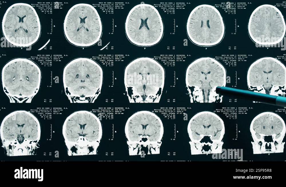 X-ray, Magnetic resonance image of head. Doctor examining human brain ...
