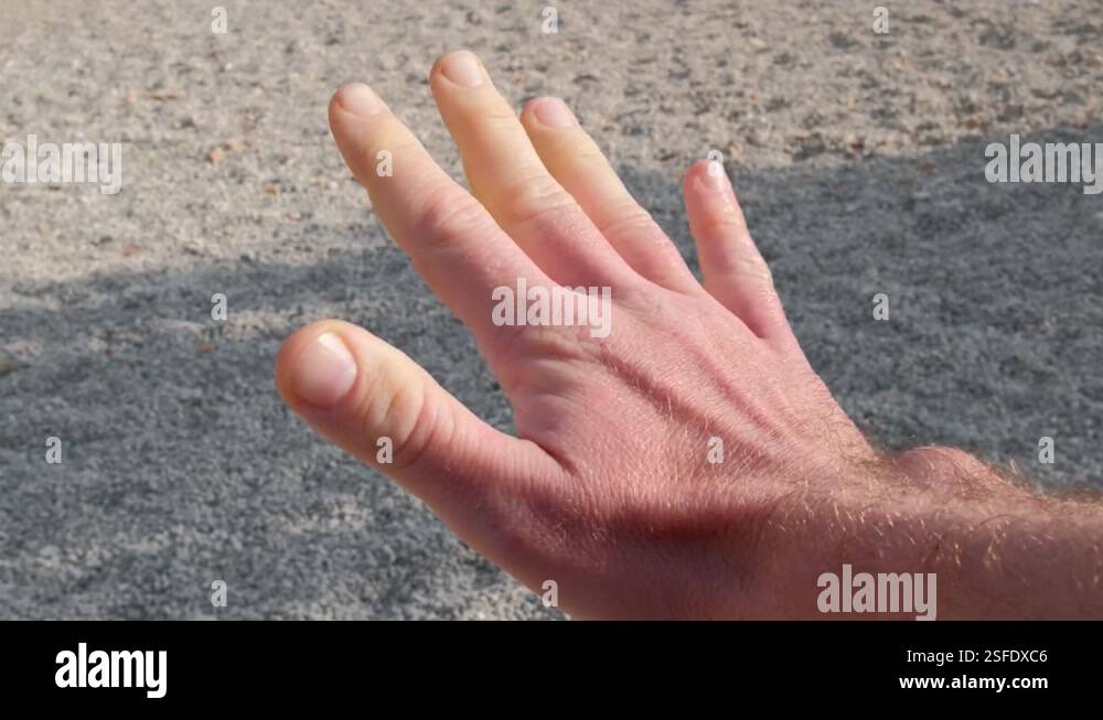 Raynaud syndrome Stock Videos & Footage - HD and 4K Video Clips - Alamy