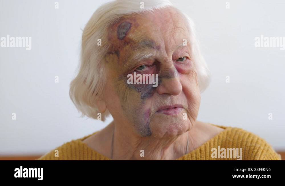 Hitting head falling Stock Videos & Footage - HD and 4K Video Clips - Alamy