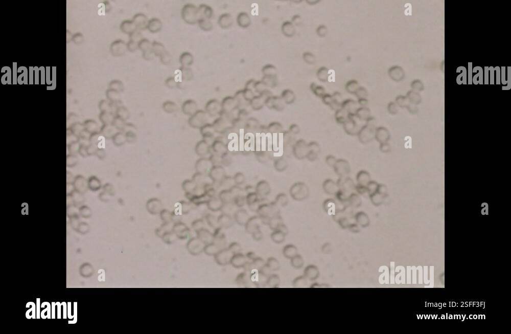 1970s: fungi on tree. Organism under microscope. Microscopic view of ...
