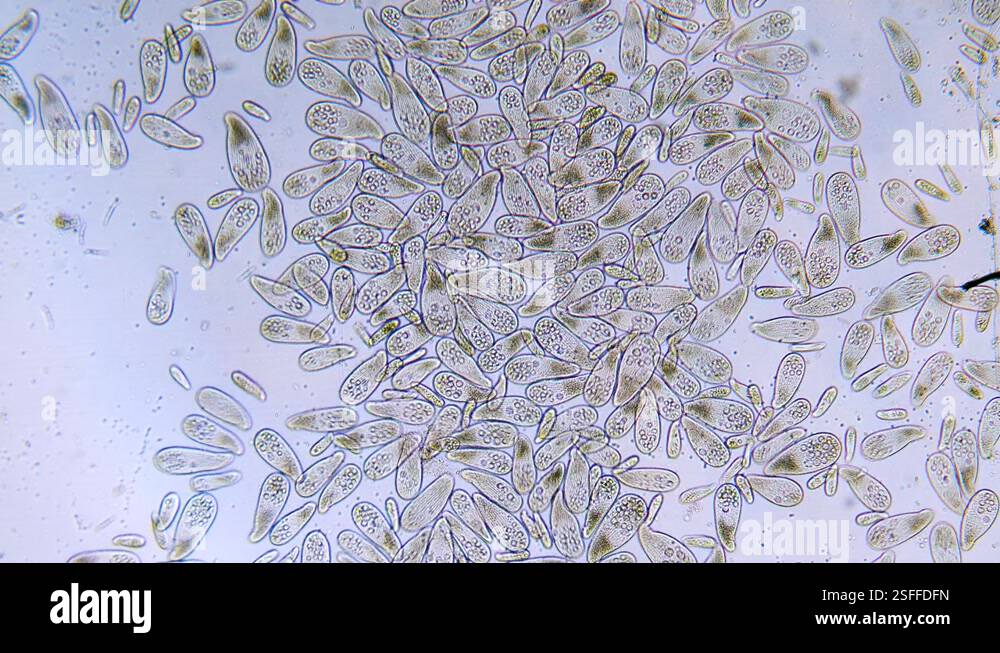 High density of unicellular paramecium protozoa under microscope Stock ...