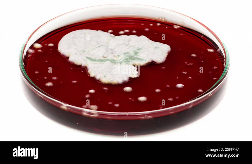 GMO bacteria decomposing plastic, time-lapse footage Stock Video ...
