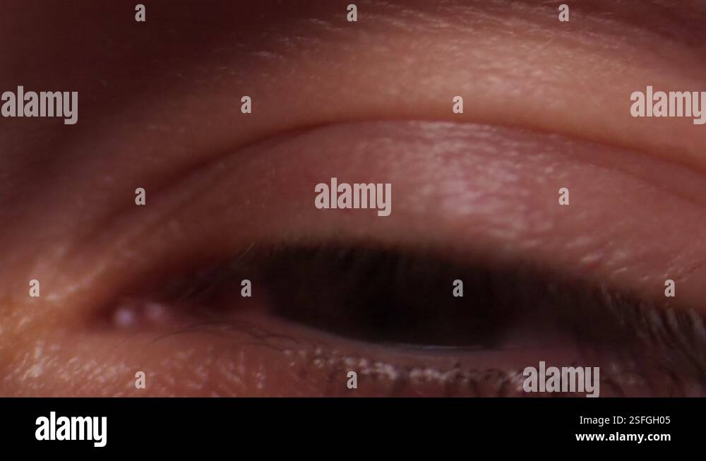 Human eyes with red veins. Potential problems with visceral health by ...