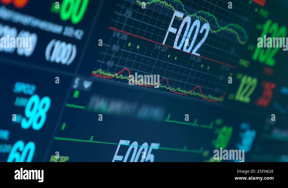 Heart rate monitor screen with live graph and numeric data of heart ...