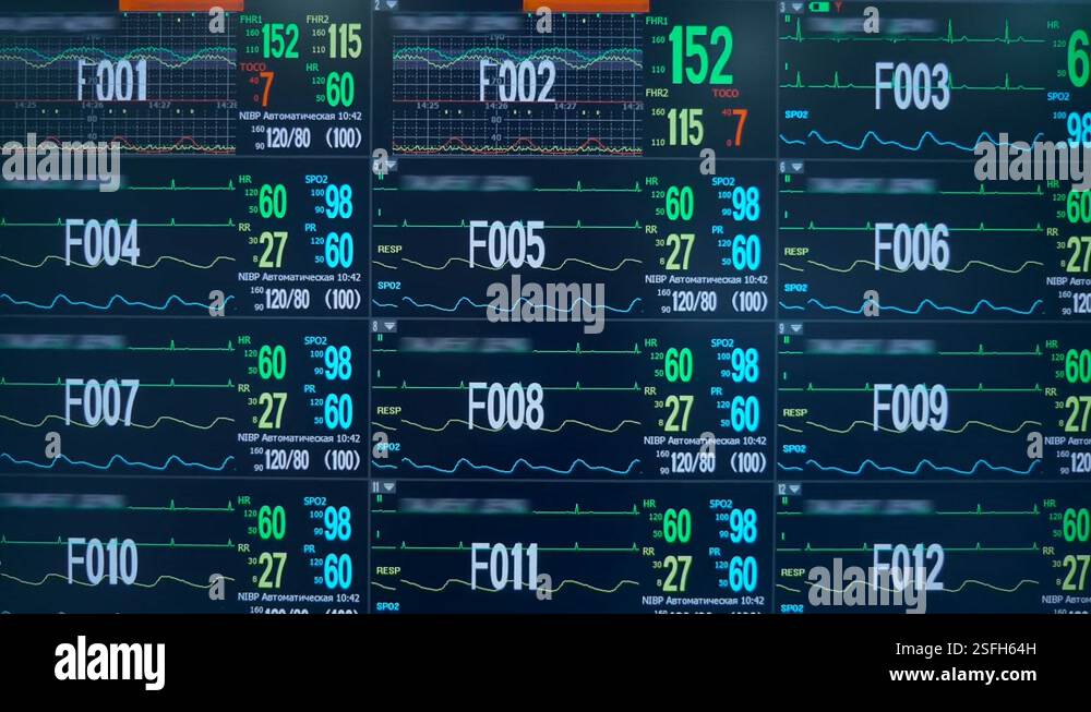 Heart rate monitor screen with live graph and numeric data of heart ...