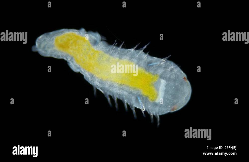 Polychaeta larva under microscope, family Dorvilleidae, possibly genus ...