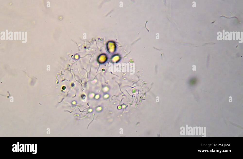 microorganisms in a drop of water from a freshwater lake Stock Video ...