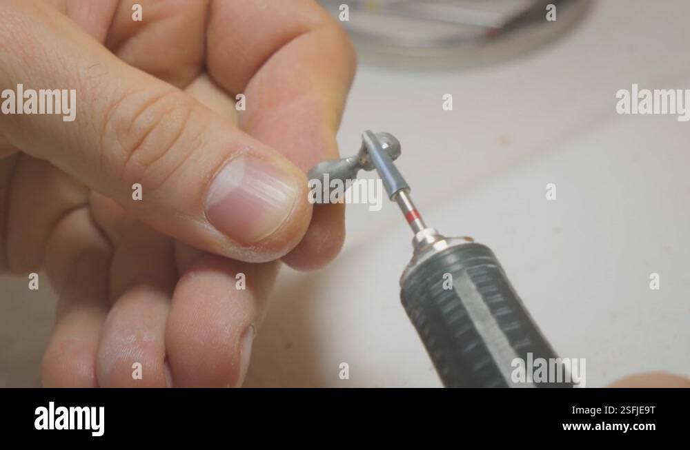 Dentist is polishing the dental bridge for teeth replacement with an ...
