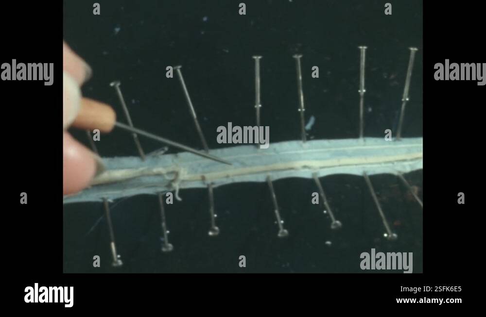 1950s: Pinned out specimen on intestinal parasite. Gastro vascular ...
