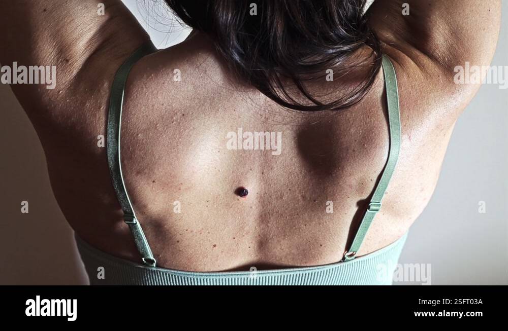 A visit to a dermatologist, showing problematic back skin with a ...