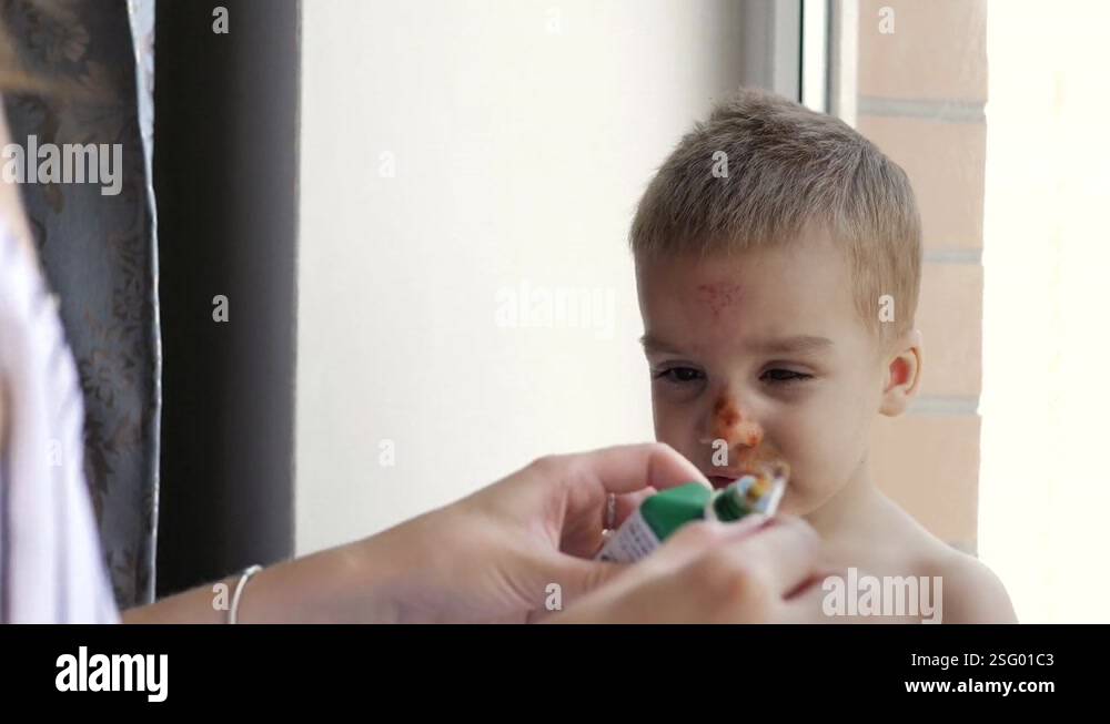 A caring mother applying antiseptic cream to a scratch and a bump on ...