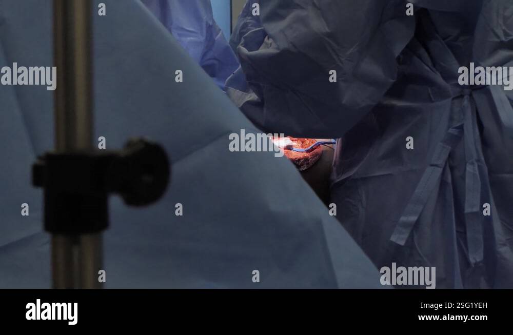 Surgical operation abdominoplasty. Close-up of the patient on the ...