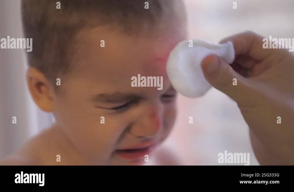 Crying baby. A caring mother applying antiseptic cream to a scratch and ...