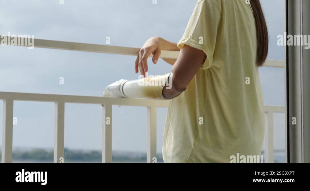 Portrait happy woman with prosthetic arm relaxing at home, girl with ...