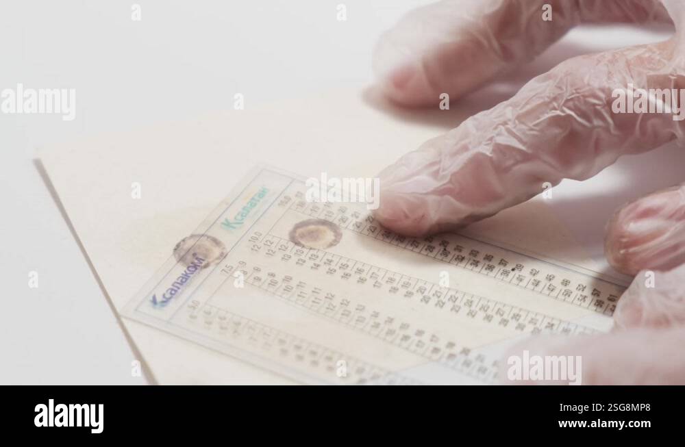 Optometrist examines the imprint of the retina with a special ruler ...