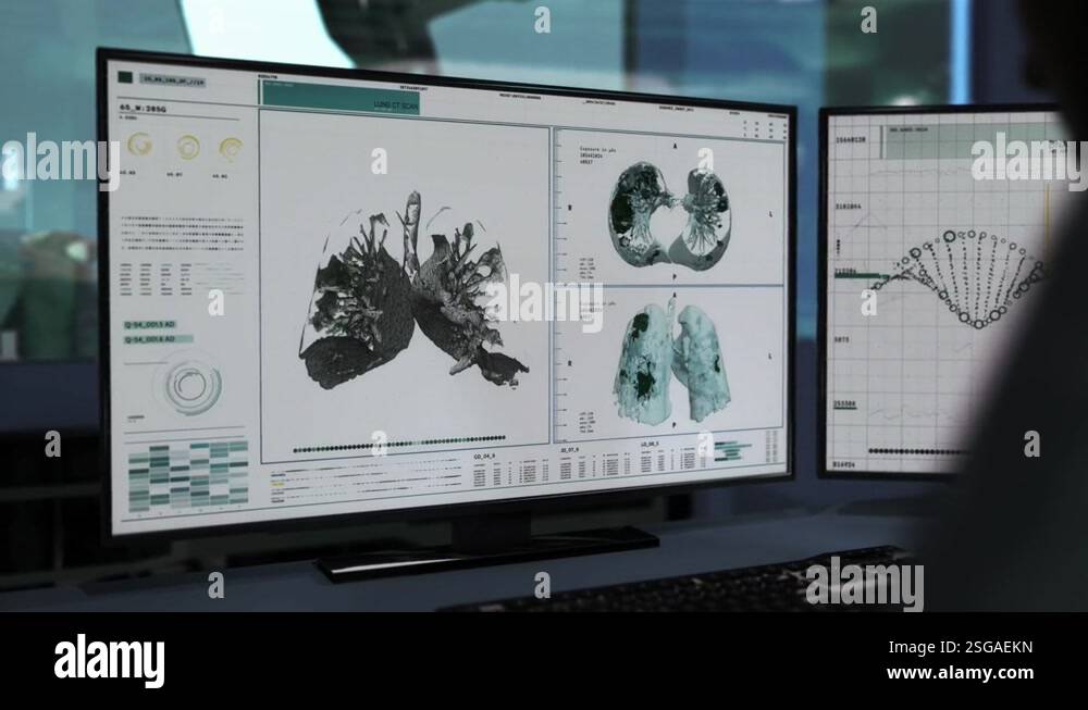 Software tool for image analysis. Lungs scan analysis. Covid-19 ...