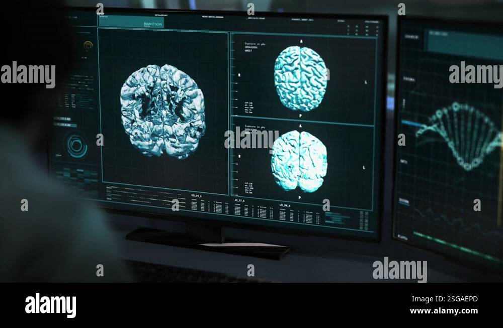 A doctor is supervising the animation of the medical brain diagnostic ...