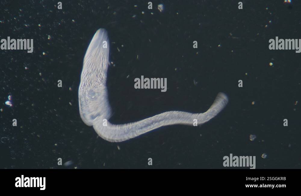 Trematode parasitic worm is escaping leaving parent body microscopical ...