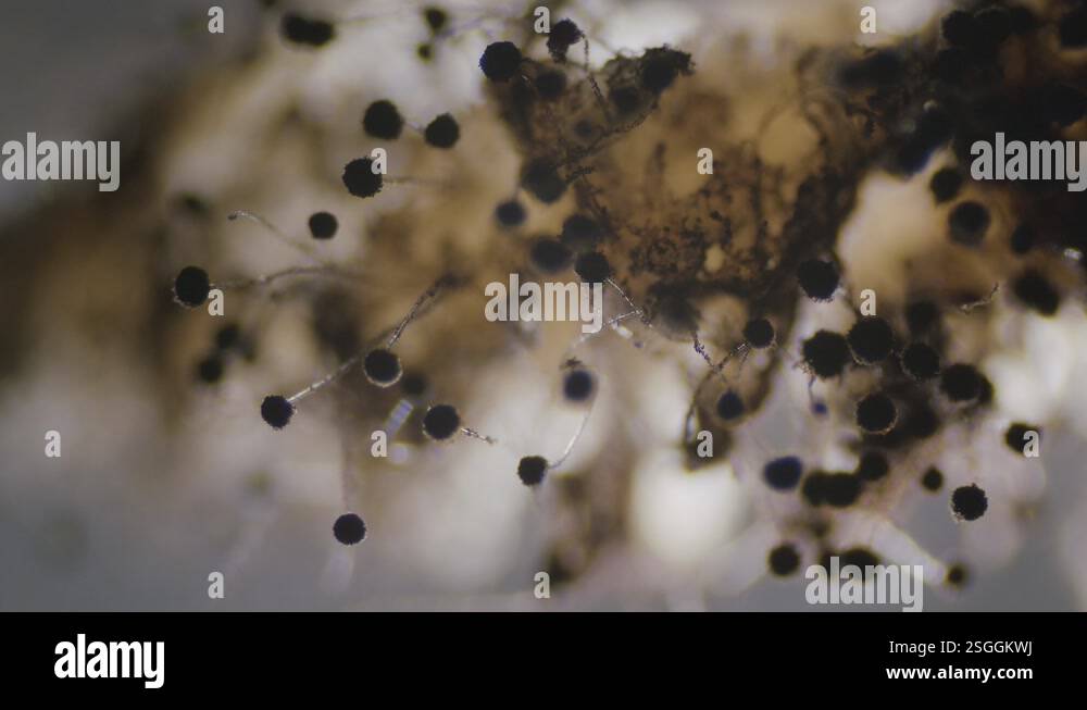 Aspergillus niger fungi mold dense cluster under microscope dark view ...