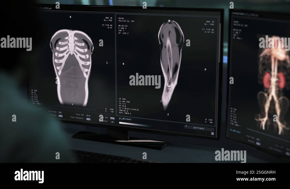 Doctor Conducts Medical Analysis Of Human Skeleton To Inspect Organ ...