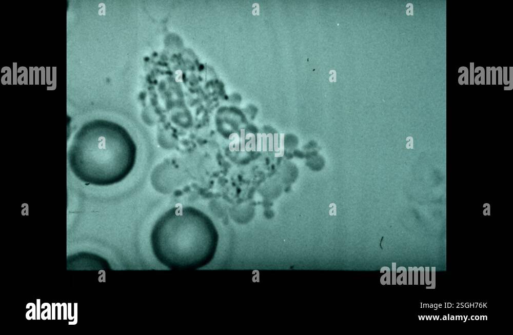 1950s: Microphotography of red and white blood cells. A white blood ...