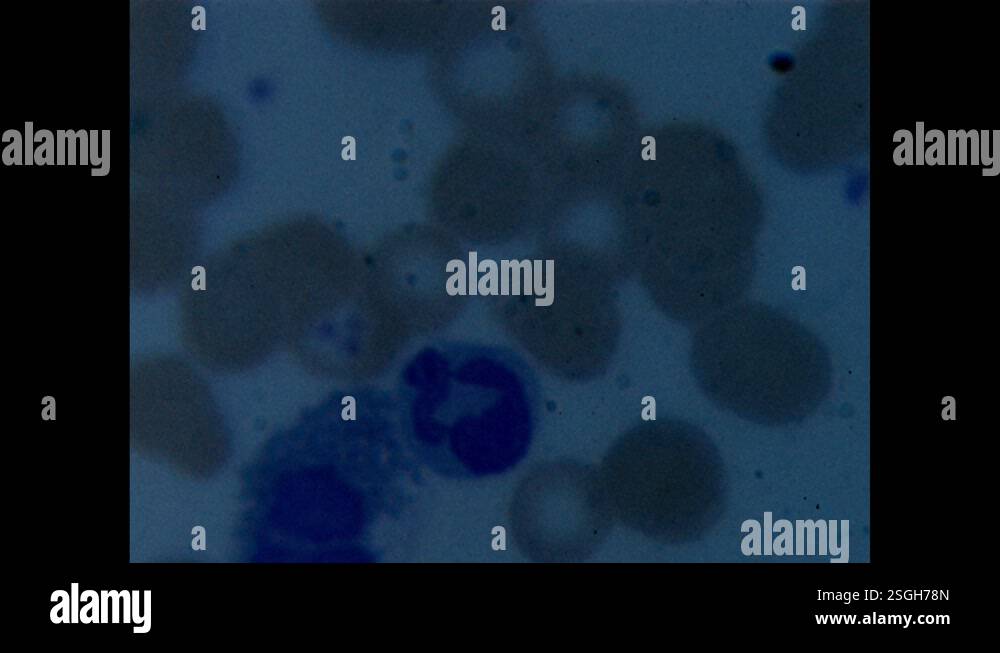 Stained microscope slide Stock Videos & Footage - HD and 4K Video Clips ...