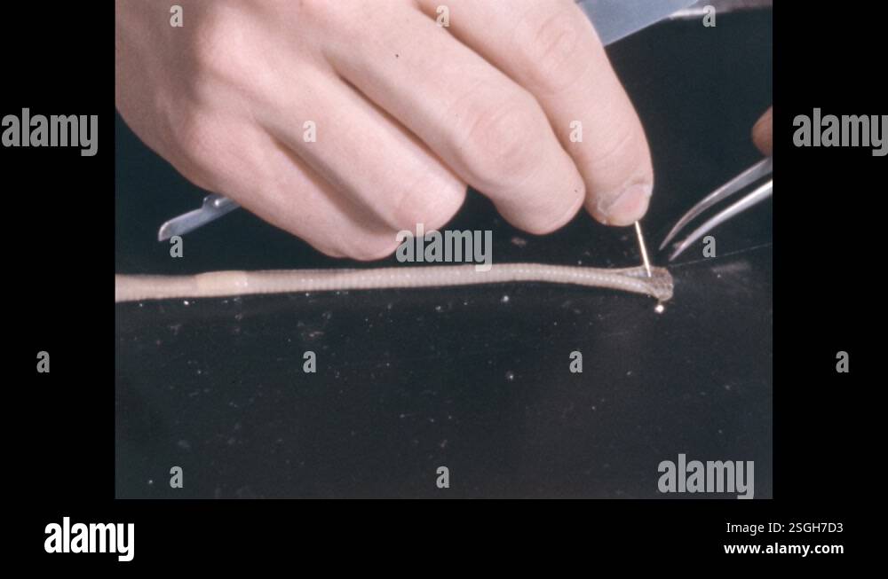Pin worm Stock Videos & Footage - HD and 4K Video Clips - Alamy