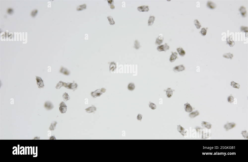Colony Rotifera Synchaeta sp. under a microscope, class Monogonta ...