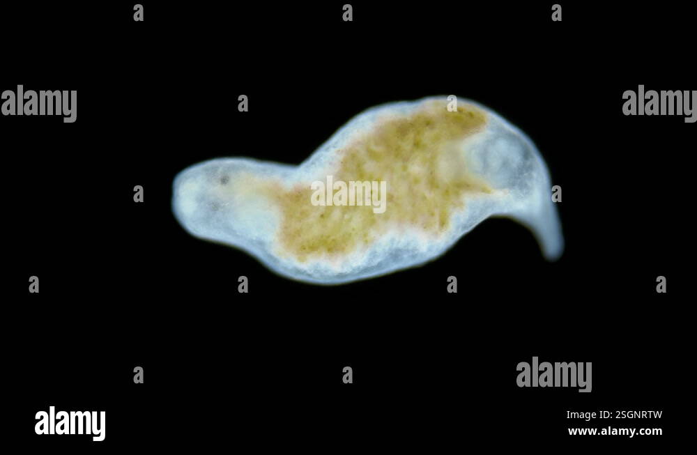 Turbellaria worm under the microscope, Platyhelminthes phylum. The ...