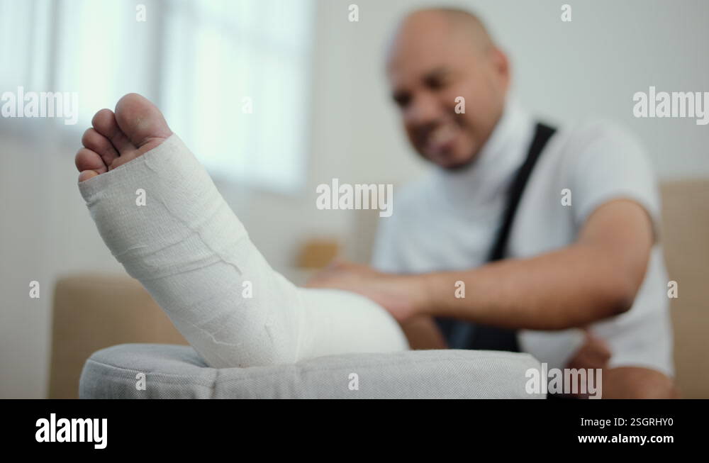 Close-up leg splints in cast of man suffered pain from accident ...