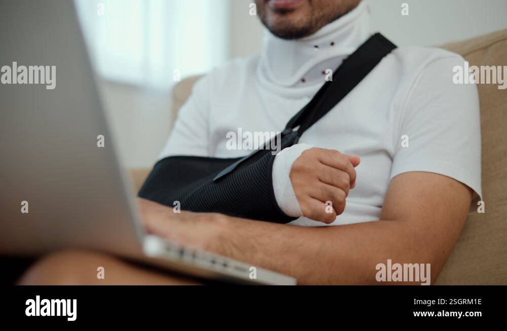 Cloes-up hand of recovery man from accident fracture broken bone injury ...