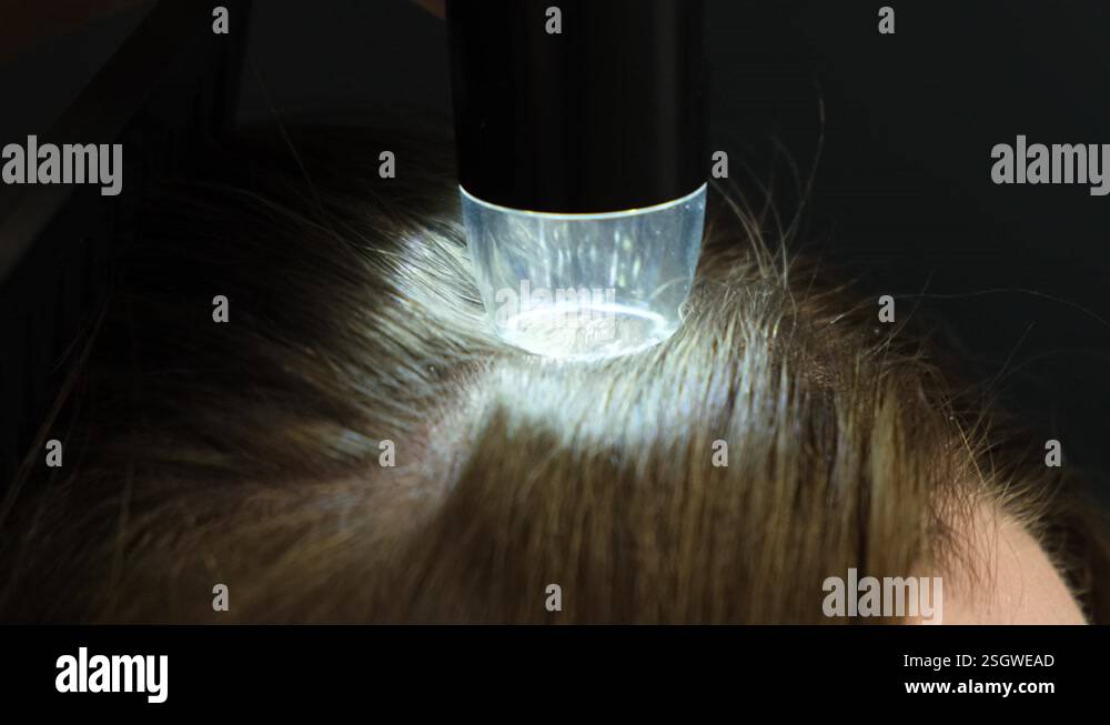 A professional trichologist examines a young woman's head using a ...