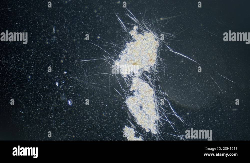 Cyanobacteria algae movement in light under microscope dark field view ...