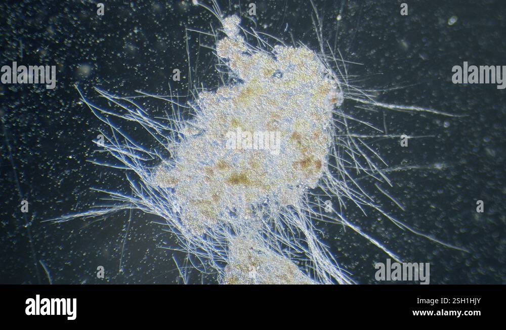 Cyanobacteria algae movement in light under microscope dark field view ...