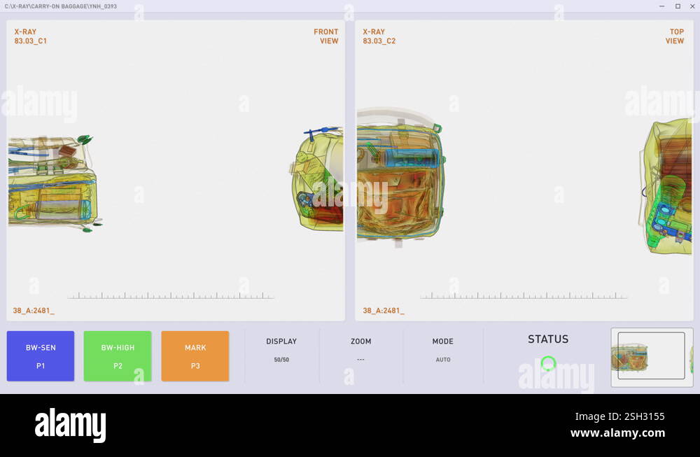 Airport Scanner Inspection Security Station Checks X-Ray Projection Of ...