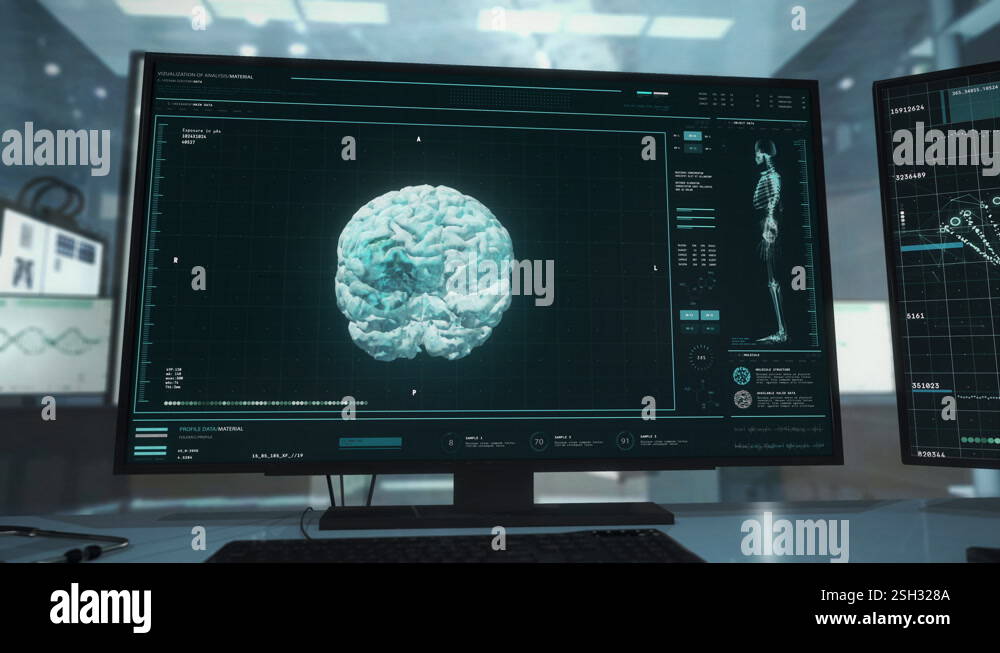 Human Patient Head Skull Scan By Advanced X-ray Screening Software ...