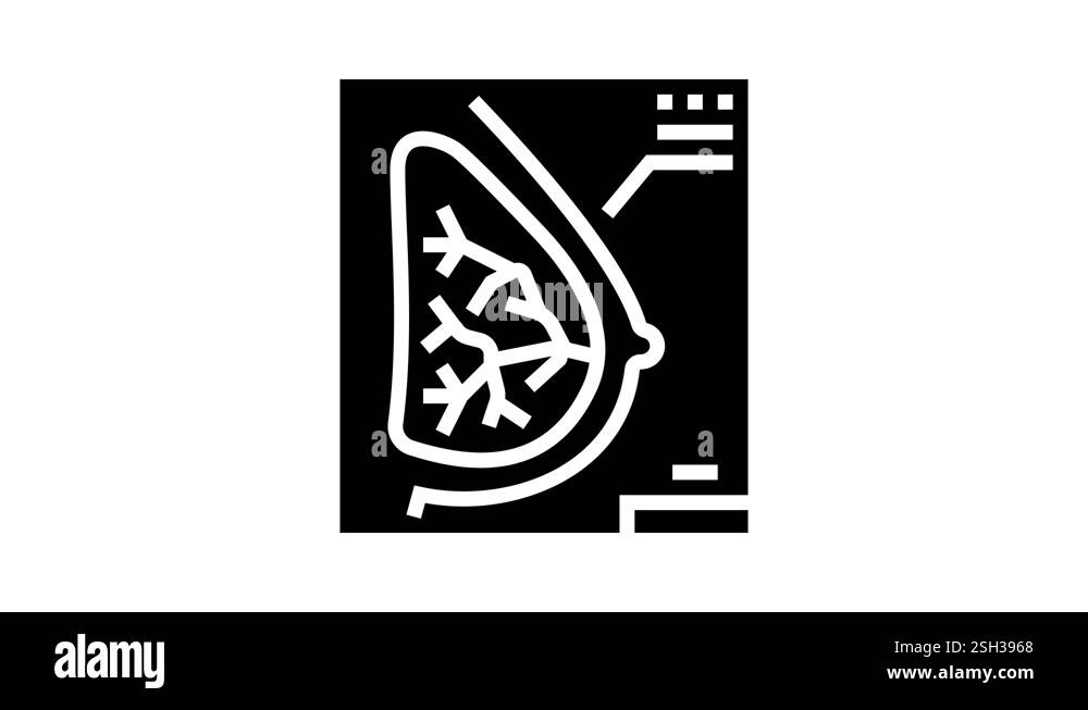 Mammogram examination Stock Videos & Footage - HD and 4K Video Clips ...