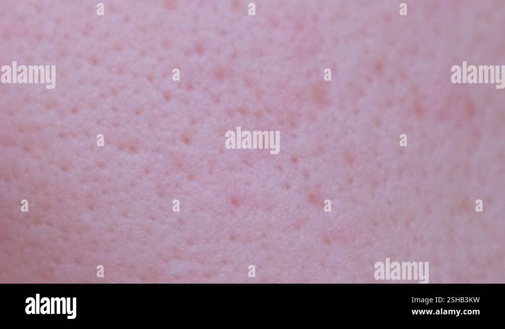 Macro shot video of problem skin on a man's face. Pores in human skin ...