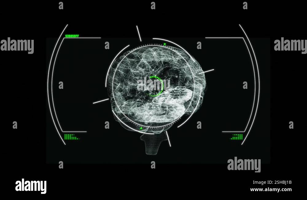Animation of glitch effect and scope scanning over spinning human brain ...