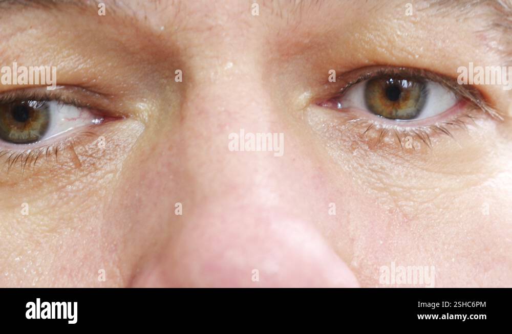 close-up. tired sleepy male eyes. the concept of fatigue and problems ...
