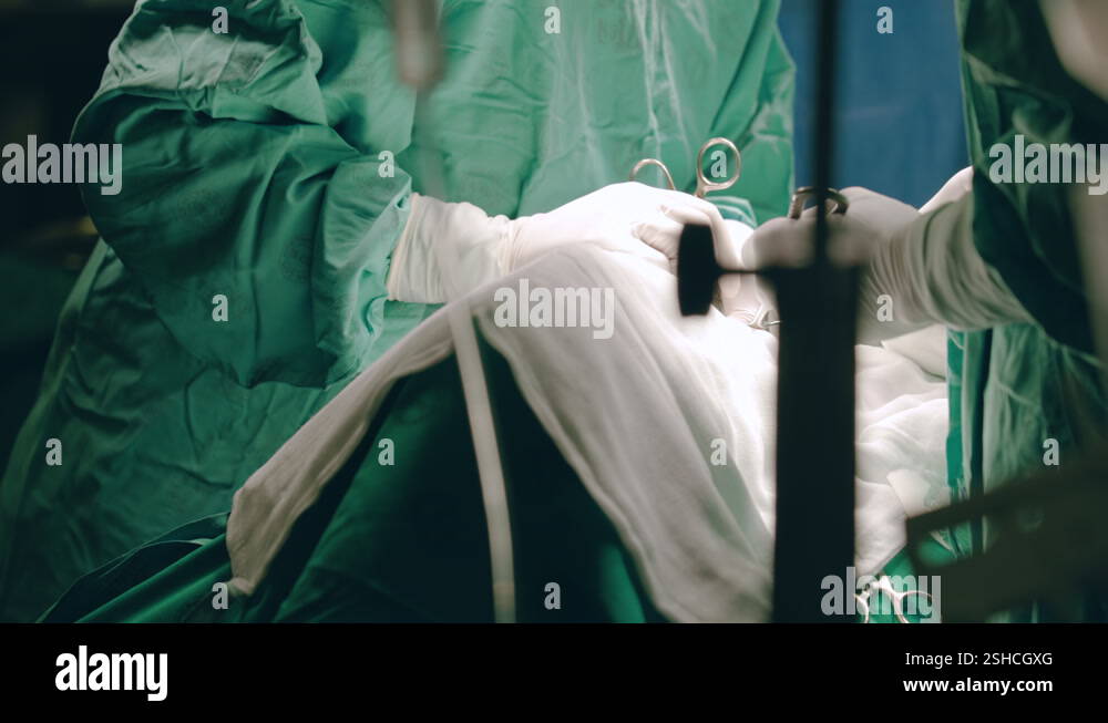 Medium shot. Medical surgeon uses forceps while performing open surgery ...